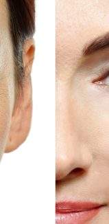 Lifting cosce: tecnica, convalescenza, esperienze e costi - Sanioggi.it